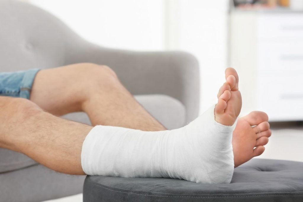 How to Care for Your Cast - Montefiore Einstein Orthopedic Surgery